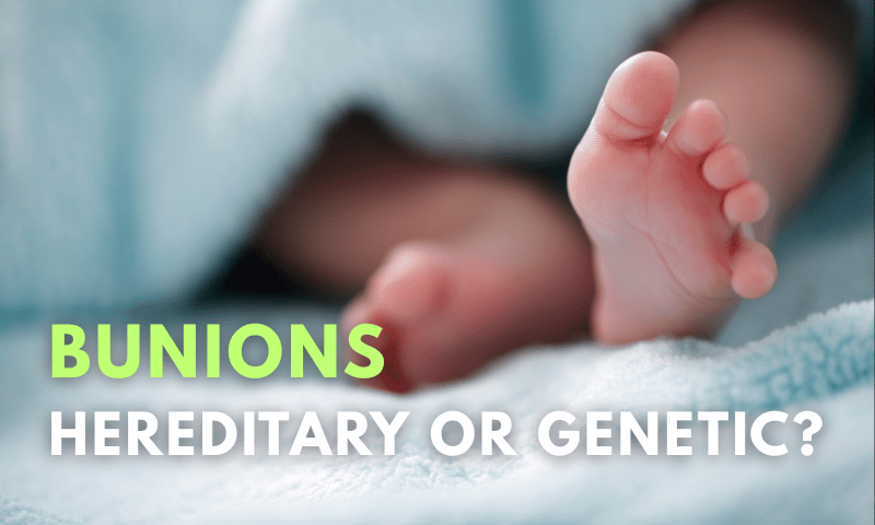 Are Bunions Hereditary or Genetic? Different Factors Explained — Feet&Feet