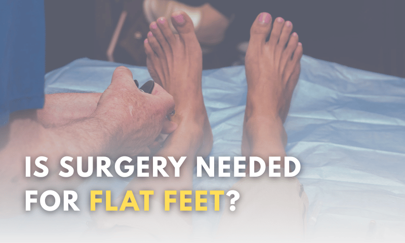 Is Surgery Needed For Flat Feet? Different Types of Surgery Explained ...