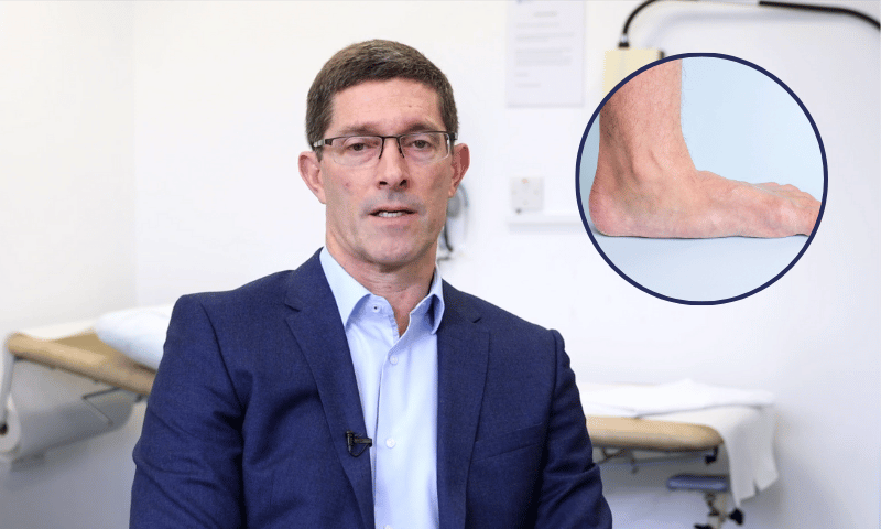 Dr. Garth Allardice Explains What Causes Flat Feet — Feet&Feet