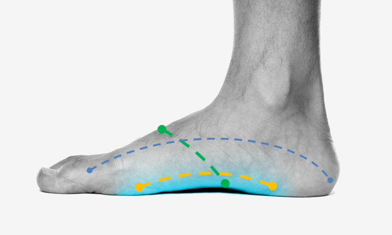 7 Most Likely Causes of Pain in the Foot Arch | Symptoms & Treatments ...